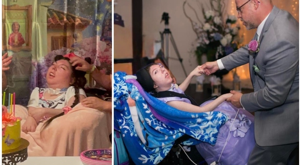 «Ha il cervello grande quanto un mignolo, non arriva a 5 anni», Alex sfida la medicina e spegne ...