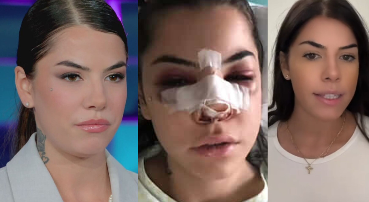 Chiara Balistreri's Journey: From Trauma to Television