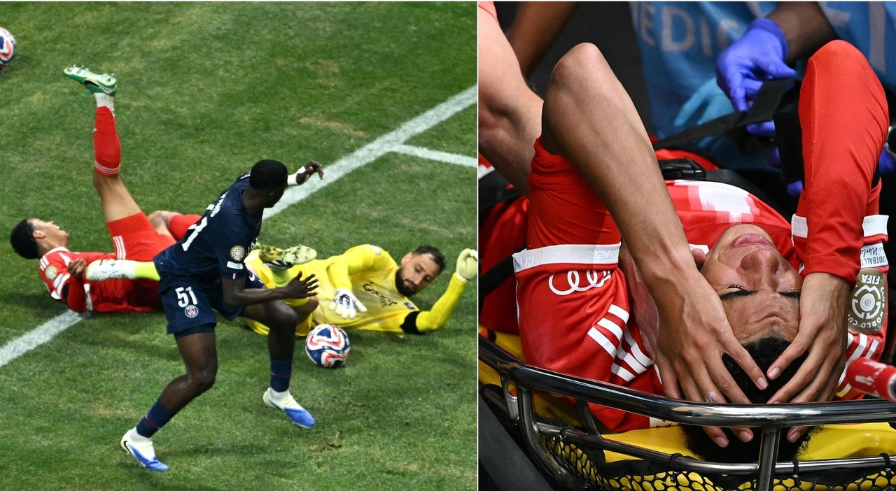 Musiala's Unfortunate Clash