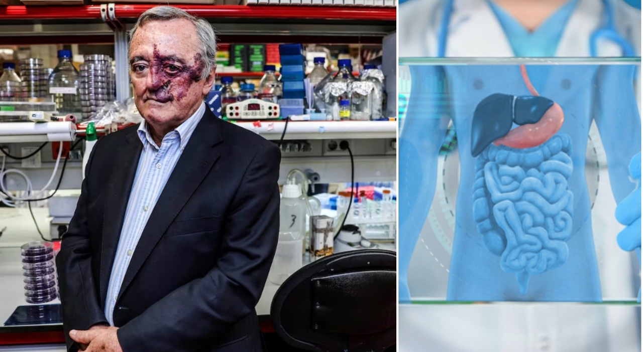 Cancro al pancreas «eliminato», la scoperta di Mariano Barbacid: così ...