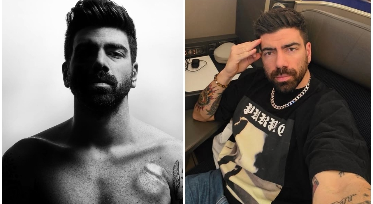 Gianluca Gazzoli mostra per la prima volta la cicatrice: «Vivo con un ...