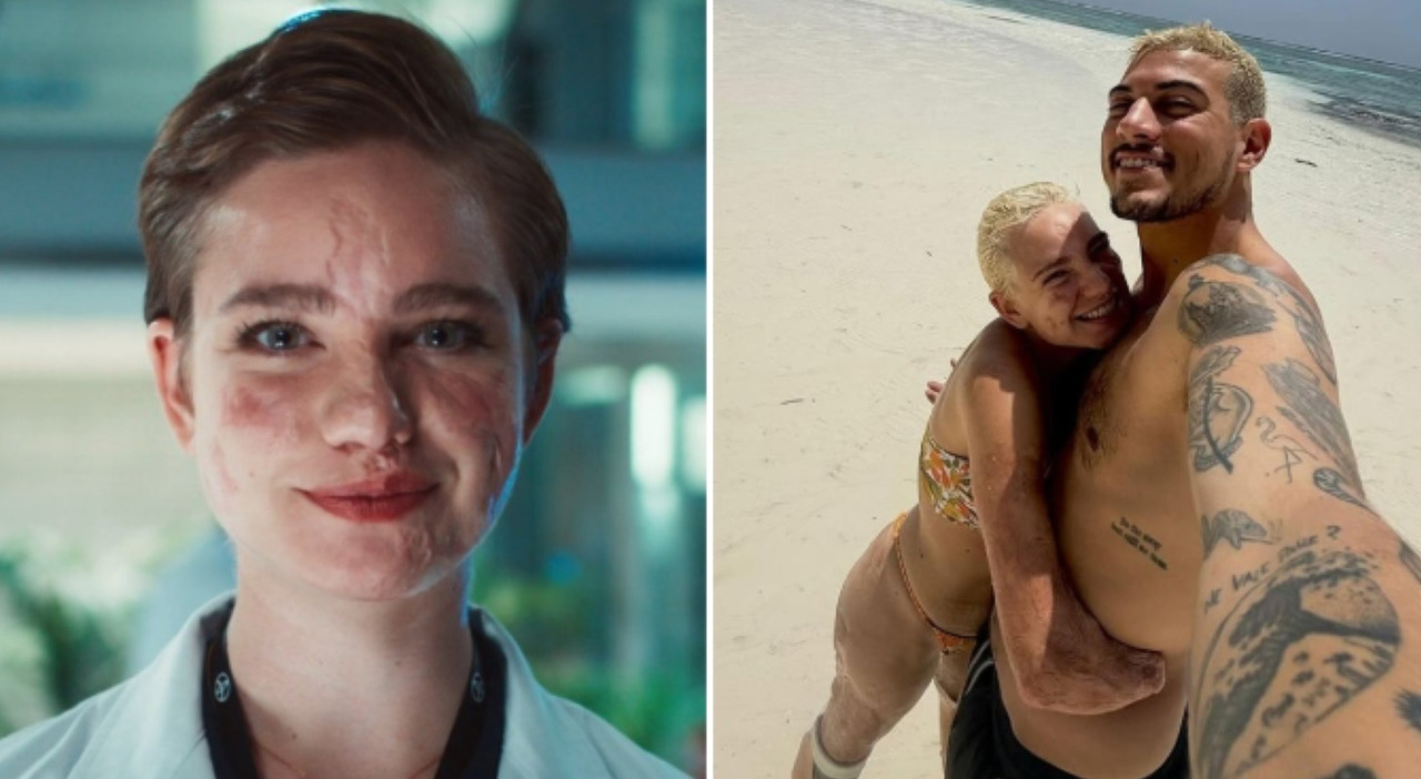 Bebe Vio's Paradise Retreat