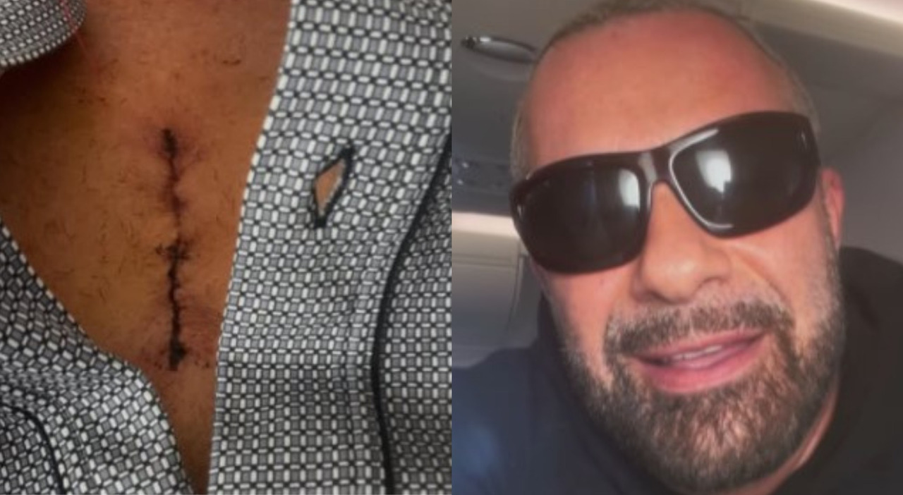 Luca Tommassini Updates Fans After Heart Surgery