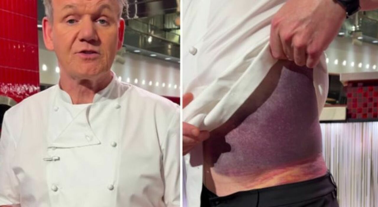 Gordon Ramsay's Bicycle Accident: A Reminder to Wear Helmets