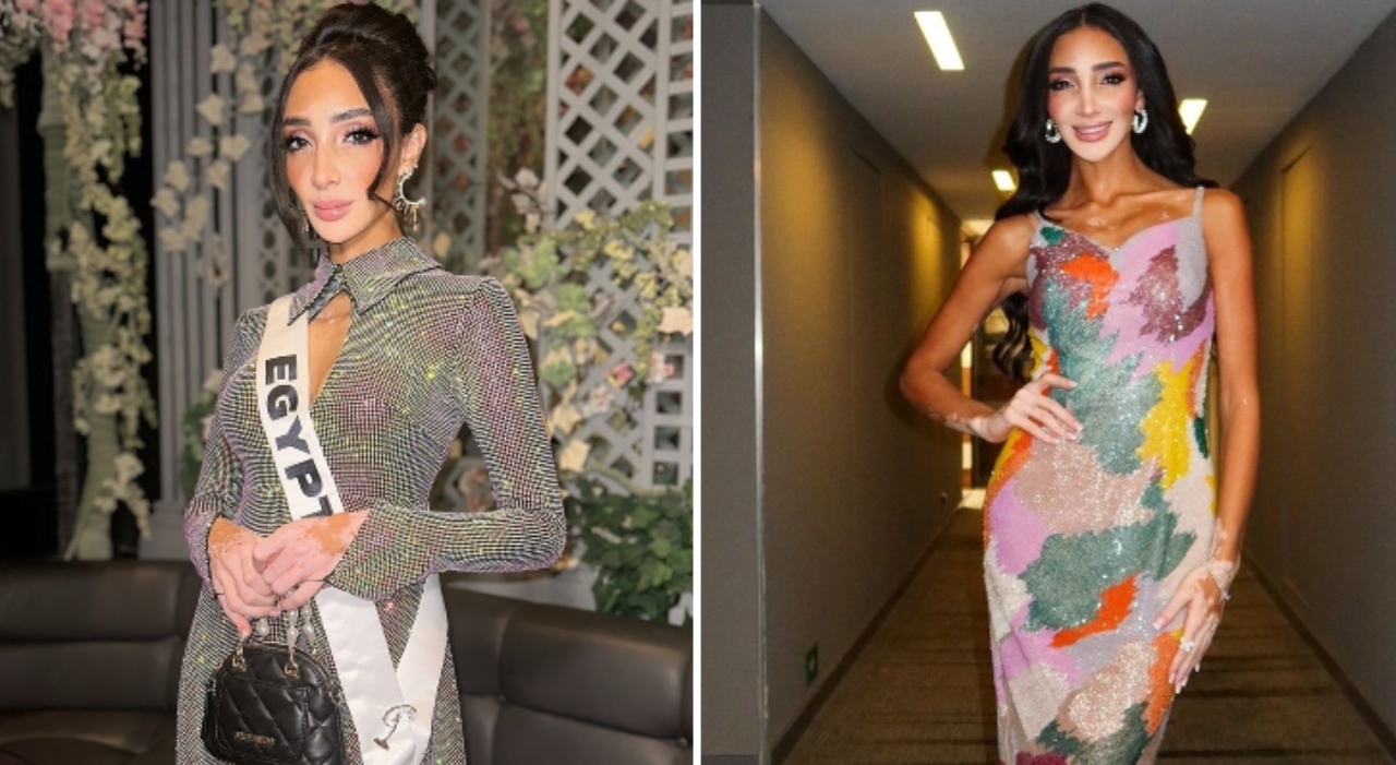Logina Salah è la prima modella con vitiligine in gara a Miss Universo ...