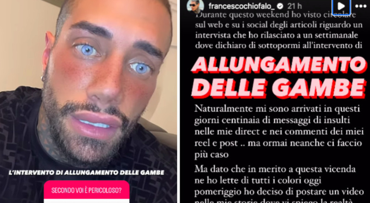 Francesco Chiofalo, dopo gli occhi l’operazione per allungare le gambe ...