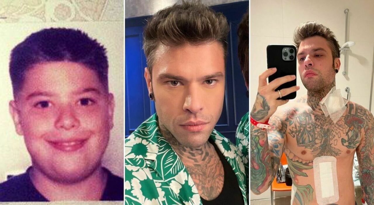 Fedez: A Journey Through Challenges and Triumphs
