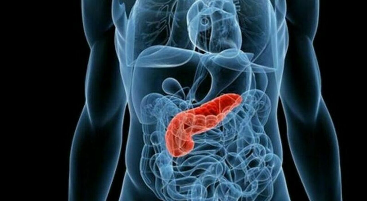 Tumore pancreas, scoperto biomarcatore che «potrebbe favorire l ...