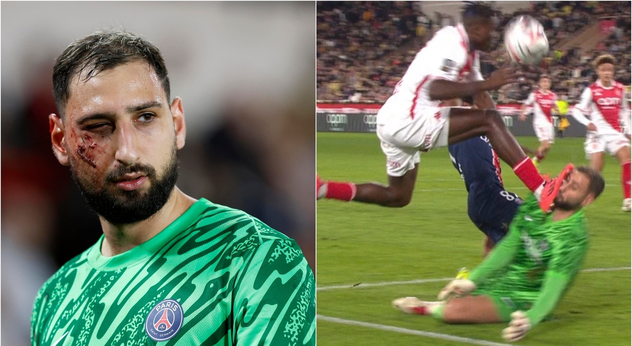 Donnarumma's injury: the diagnosis following the face kick in the ...