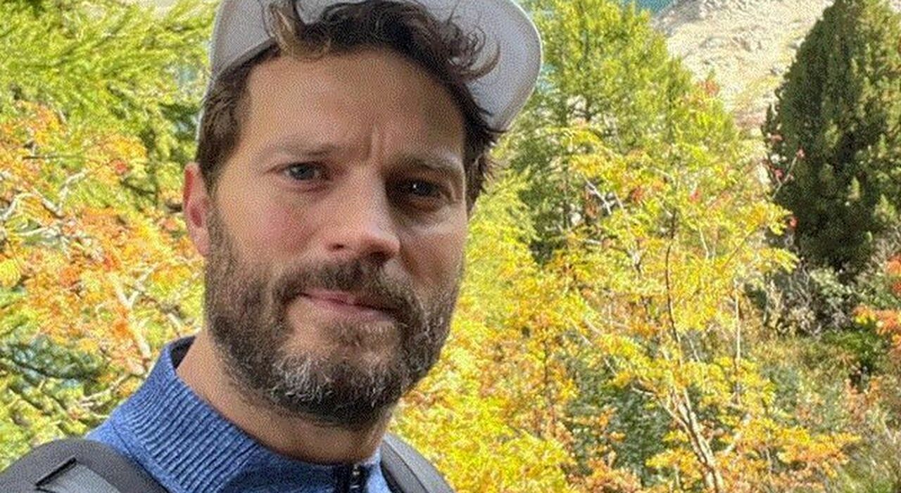 Actor Jamie Dornan Hospitalized After Venomous Caterpillar Bite