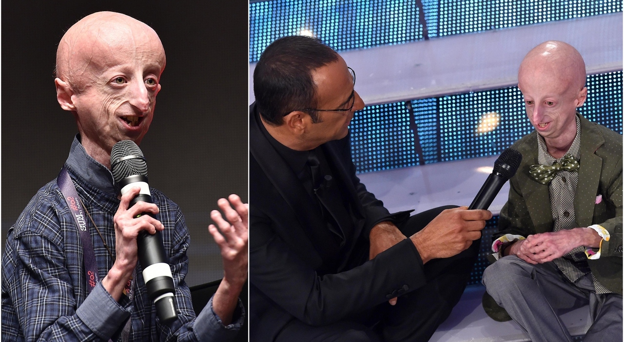 Sammy Basso Passes Away at 28: A Life Dedicated to Raising Awareness ...