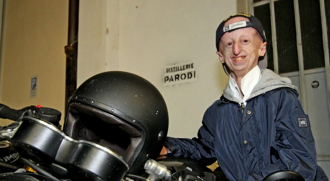 Sammy Basso morto a 28 anni, era il malato di progeria più longevo al ...