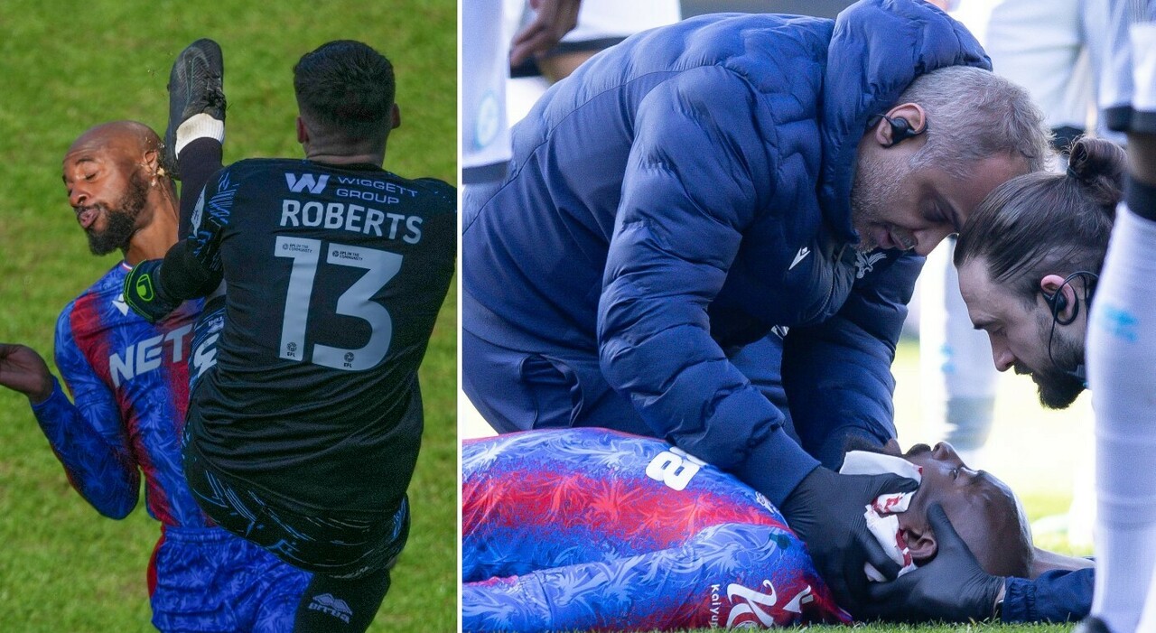 Calcio in faccia dal portiere, paura per Mateta: «Poteva mettere fine ...