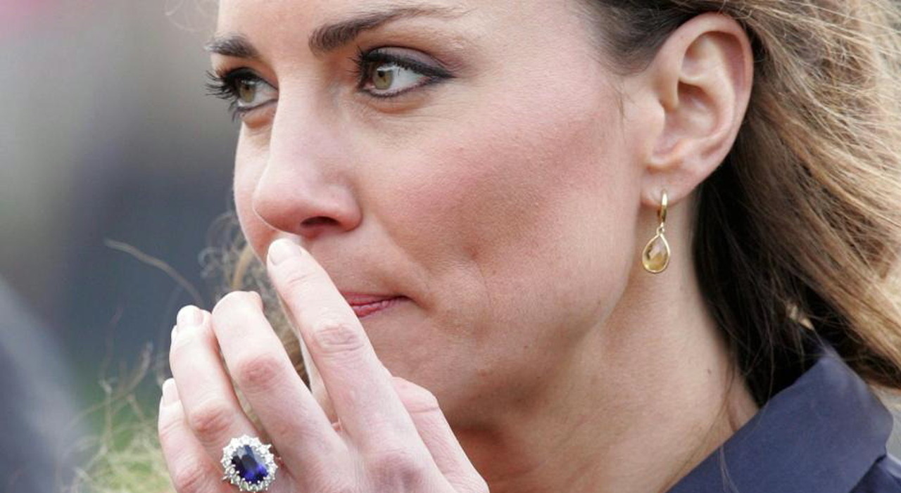 «Kate ha subito una ileostomia», l'operazione all'addome la costringe ...