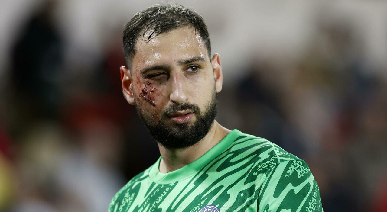 Gianluigi Donnarumma Suffers Severe Facial Injury in Champions League ...