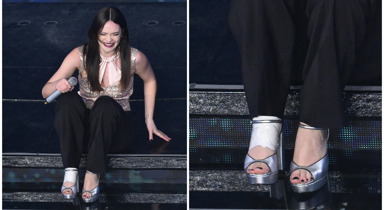Sanremo 2025, Francesca Michielin col piede fasciato e il viso ...