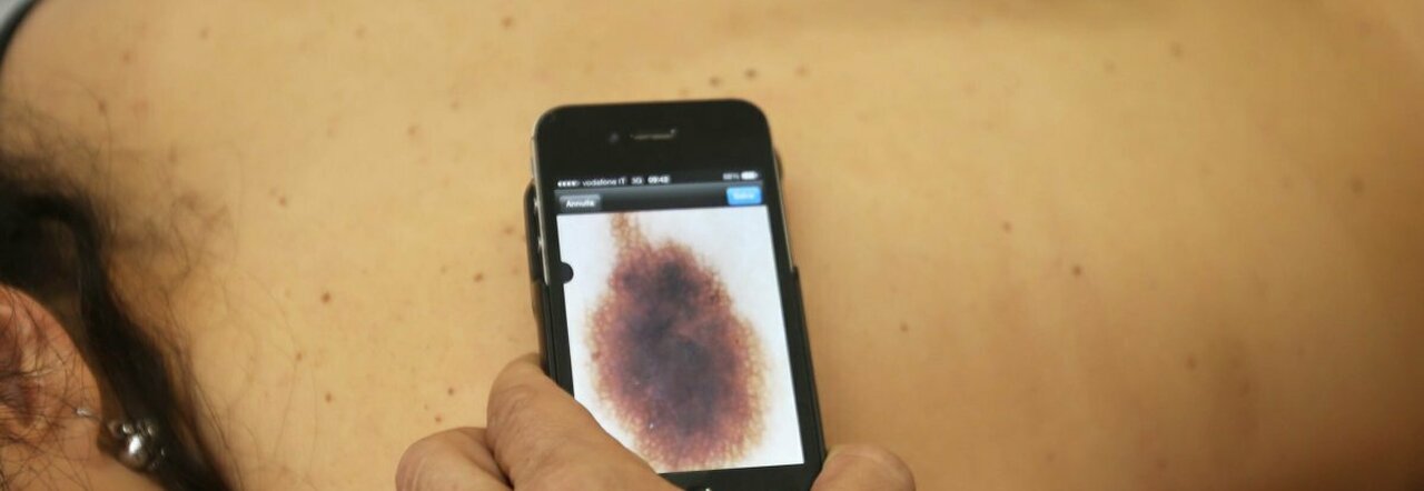 Mappatura nei affidata ai medici di base, il no dei dermatologi della ...