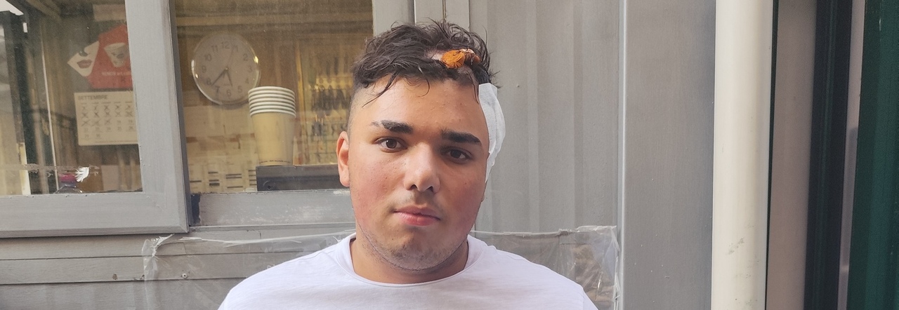Naples student attacked with hammer calls for end to youth violence ...