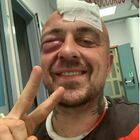 Chef Rubio senza cellulare e profili social bloccati, perquisita la ...