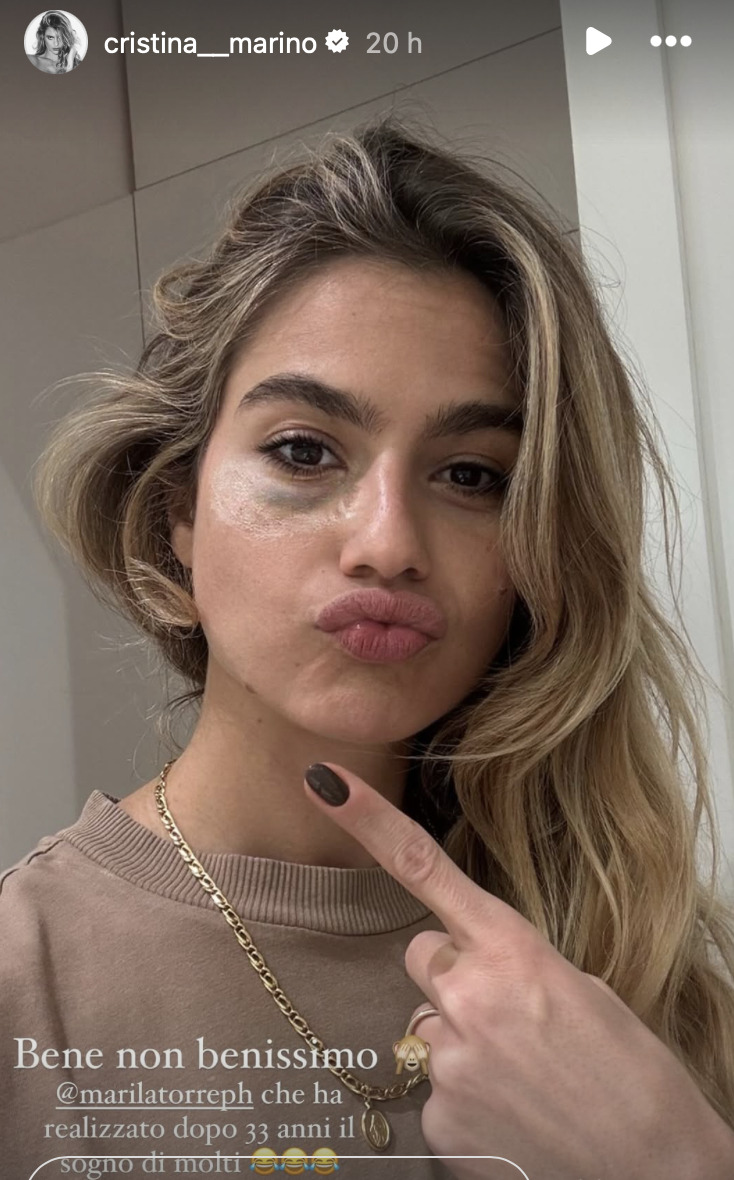 Cristina Marino e l'occhio nero: «La fotografa mi ha spaccato la ...